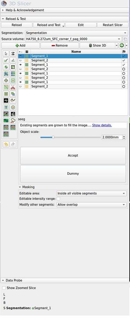 How to add additional buttons to scriptedsegmenteditoreffect ...