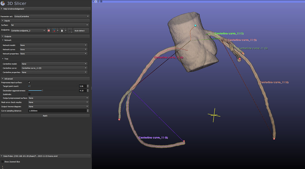 Failed Centerline Extraction with ExtractCenterline Tree - Support - 3D Slicer Community