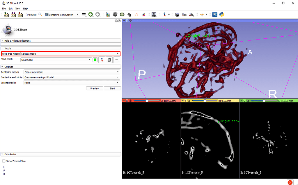 VMTK centerline computation problem - Support - 3D Slicer Community