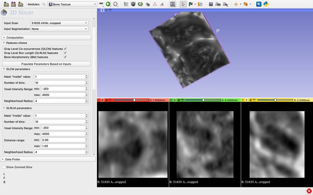 Problem with Running Bone Texture Module - Support - 3D Slicer Community