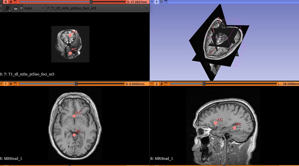 Showing Multiple Scalar Volume Node Slices in 3D View - Support - 3D Slicer Community