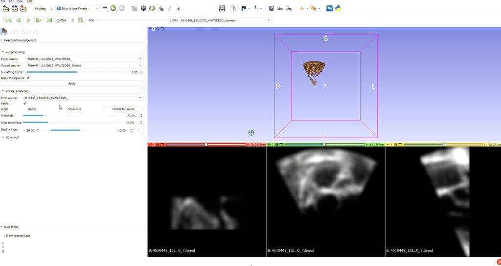 CARDIAC module: echo Volume Render Bug - Support - 3D Slicer Community
