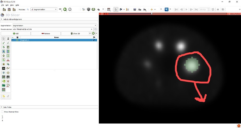How to put annotations in picture - Support - 3D Slicer Community