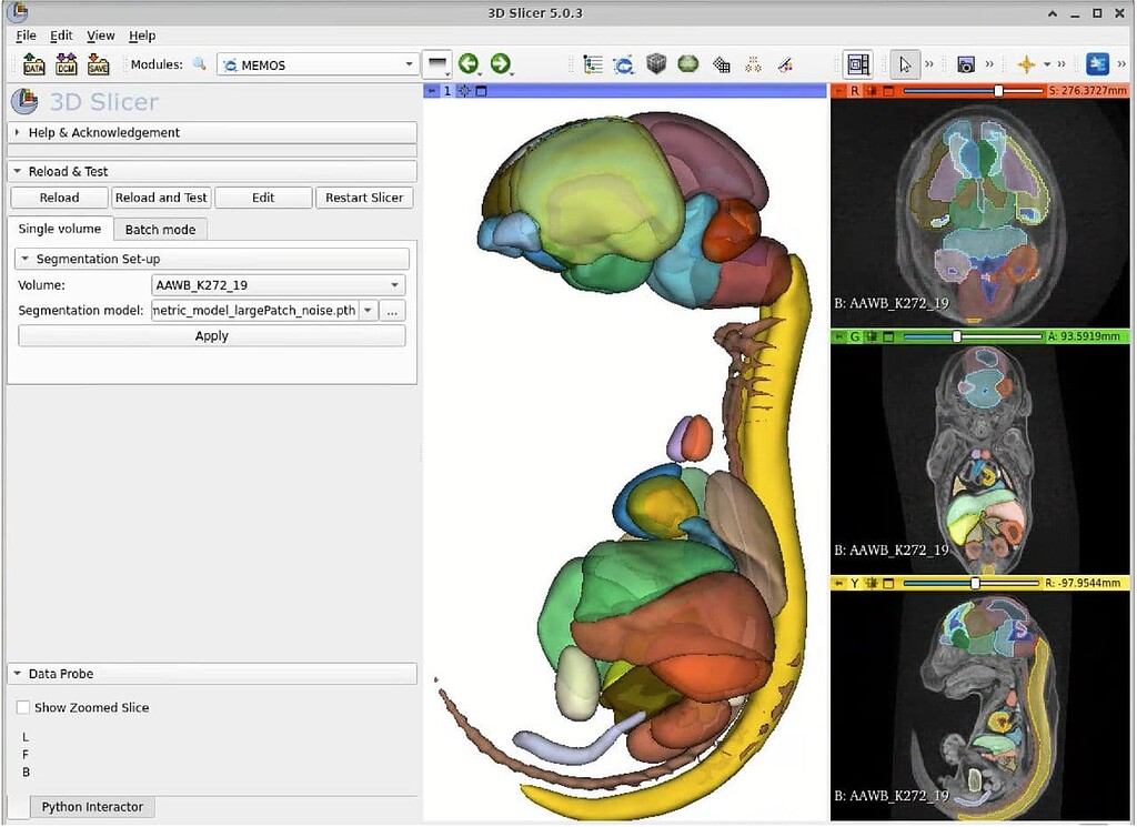 MEMOS: New extension for deep-learning based segmentation of 3D fetal mice scans ...