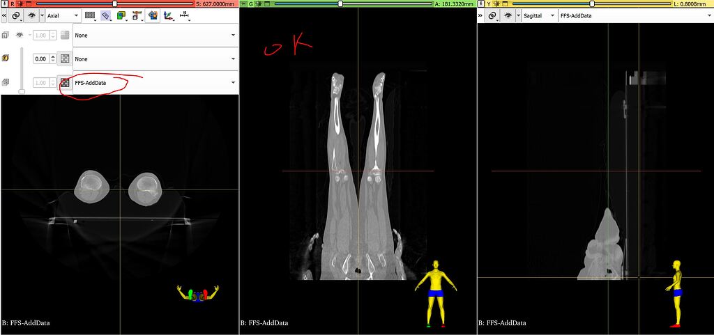 Loading a FFS CT Volume using "Add Data" vs "Import Dicom files" - Support - 3D Slicer Community