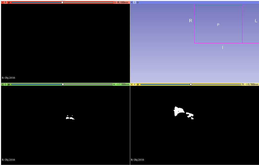 I Want To Use The Software To Do Superimposition Of Cbct Files But When I Insert My Cbct In