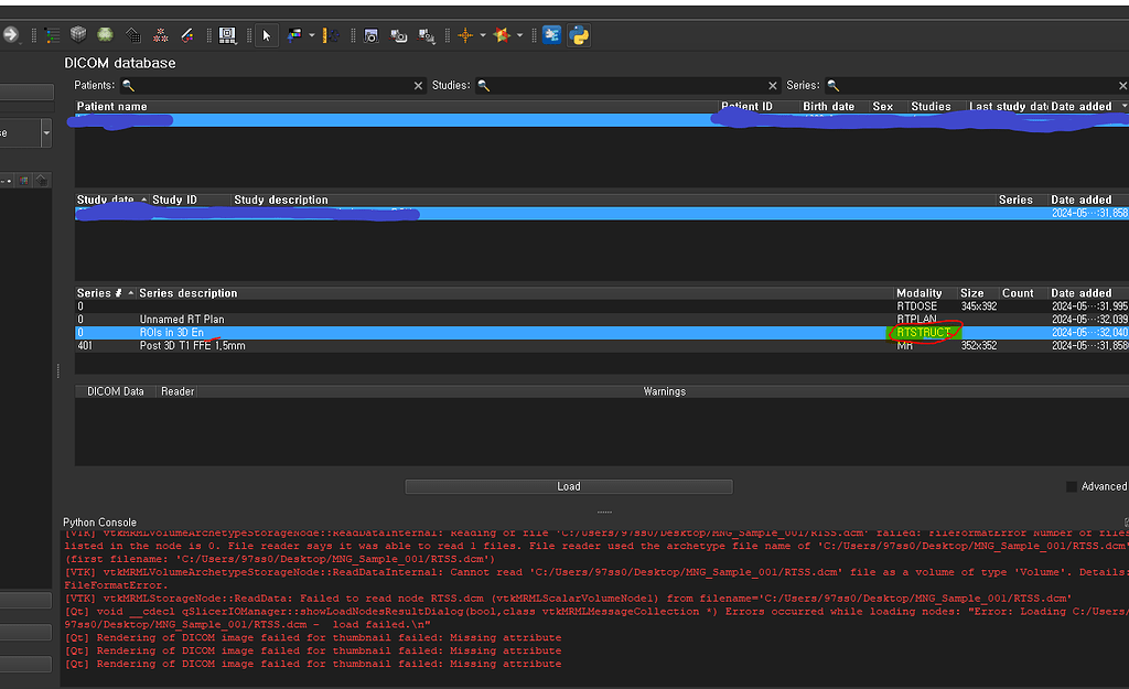 Import Rtss Dicom Files Already Slicerrt Is Installed Support 3d Slicer Community