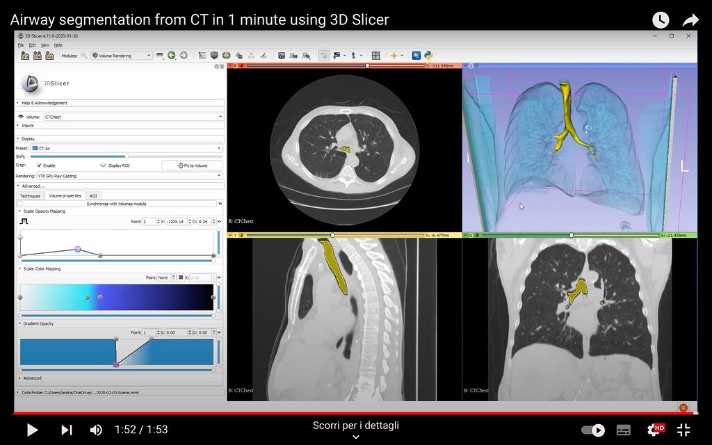 How to export volume rendering from slicer to Hololens 2 - Support - 3D Slicer Community