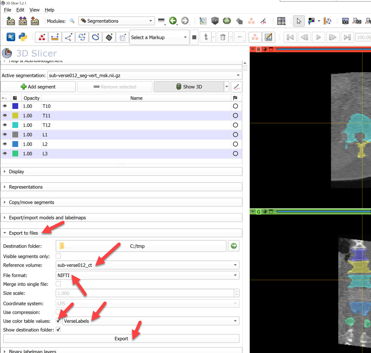 Export Segmentation As Labeled Labelmap Support 3d Slicer Community