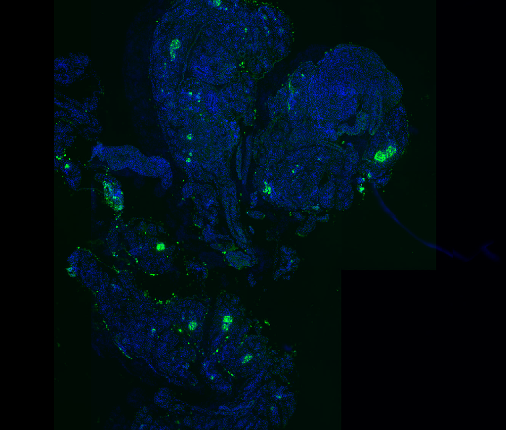 Fluorescence Images (.scn format) - Image Analysis - Image.sc Forum