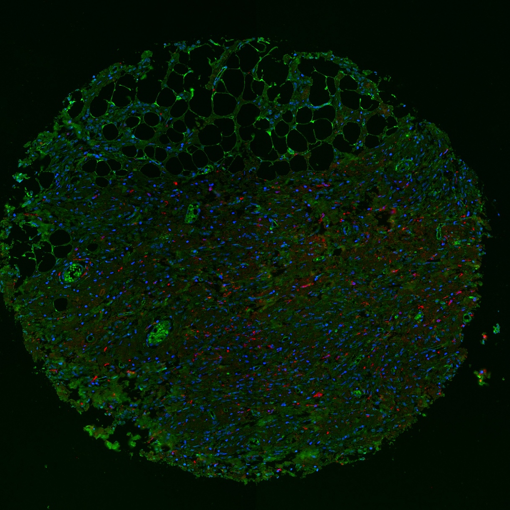 Colocalization analysis - Image Analysis - Image.sc Forum