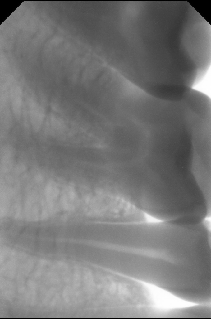 Enhancing Image quality of an Radiograph - Image Analysis - Image.sc Forum