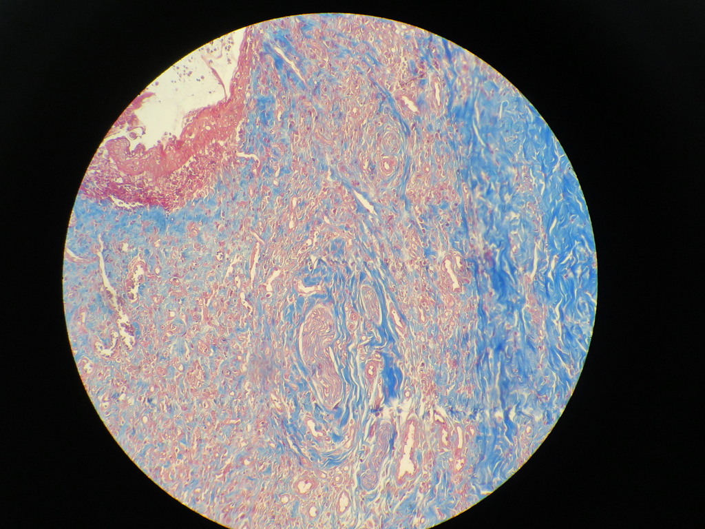 Trainable Weka Segmentation (Masson Trichrome) - Image Analysis - Image.sc Forum