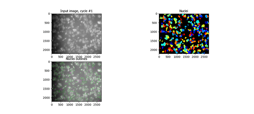 Primary and Secondary Object Divisions - Image Analysis - Image.sc Forum