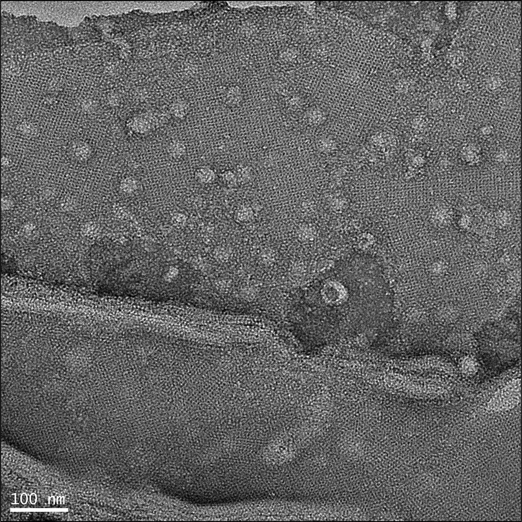 Measuring the area of crystals in TEM image using ImageJ - Image ...