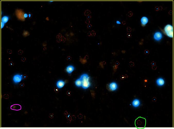 Cell detection issues in Qupath - Image Analysis - Image.sc Forum