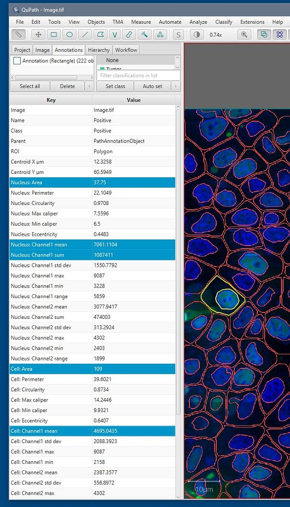 QuPath Detection measurements - Image Analysis - Image.sc Forum