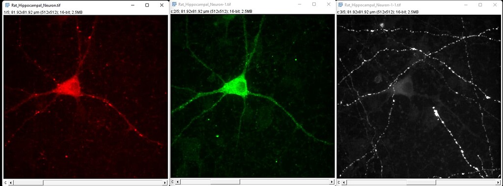 Neuron segmentation - Image Analysis - Image.sc Forum