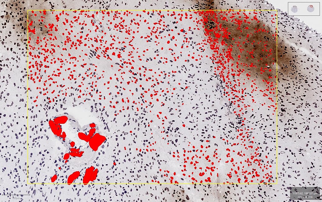 Universal StarDist for QuPath - Transfer Pretrained Models Across Modalities With Ease ...