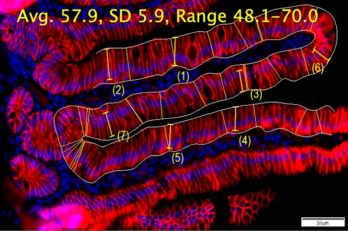 ImageJ macro to measure distance between two lines/edges ...