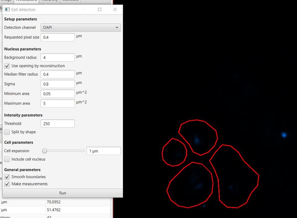 Cell detection issues in Qupath - Image Analysis - Image.sc Forum