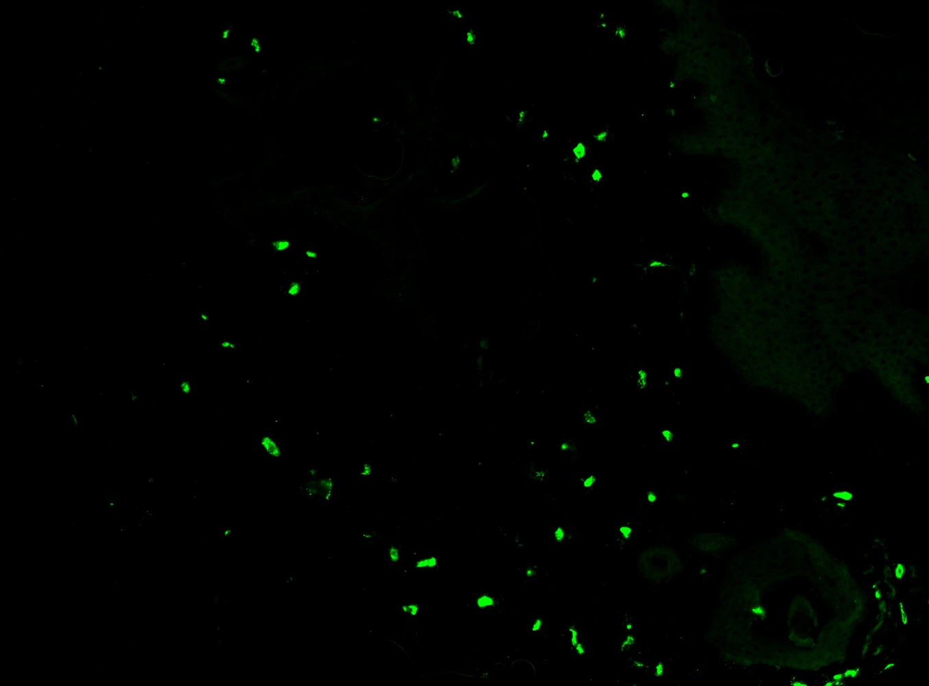 Qupath: Fluorescent image analysis using colocalization of objects in different channels - Image ...