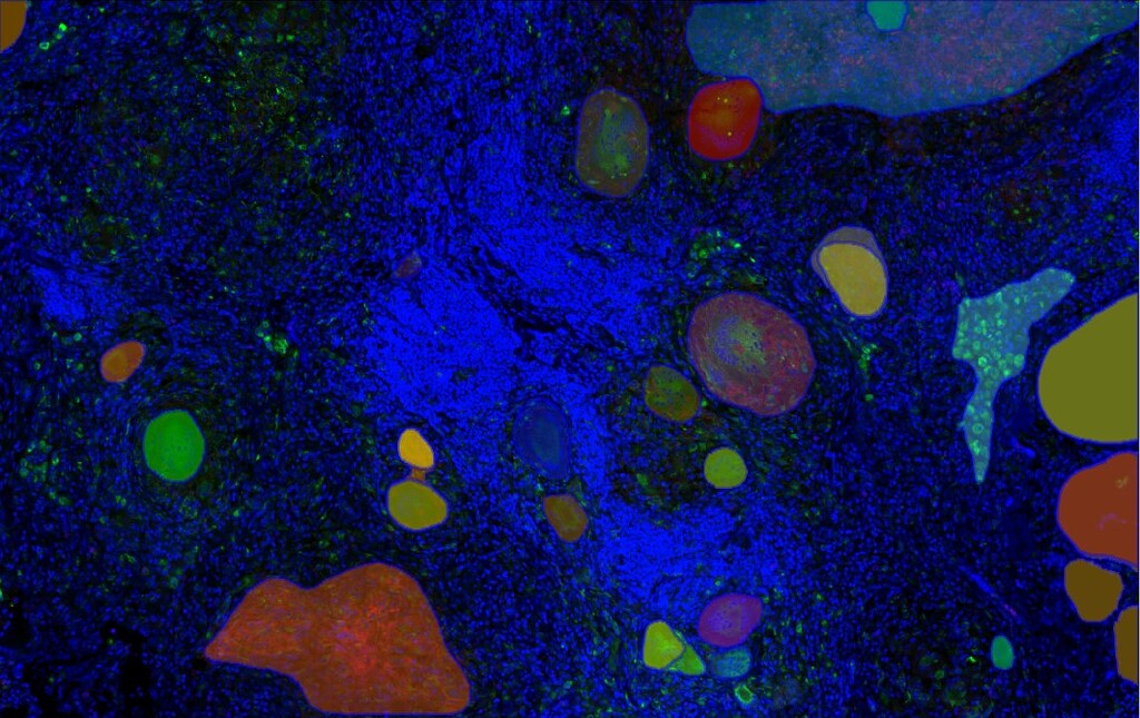 MGCs segmentation using Meta Segment Anything Model - Image Analysis ...