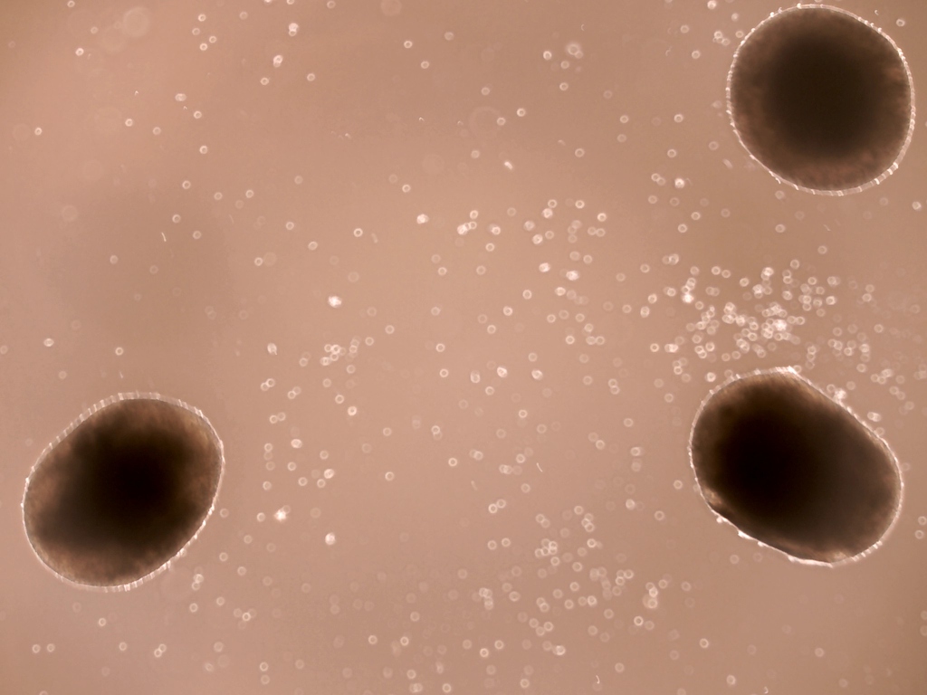 Help Identifying Primary Objects - Image Analysis - Image.sc Forum