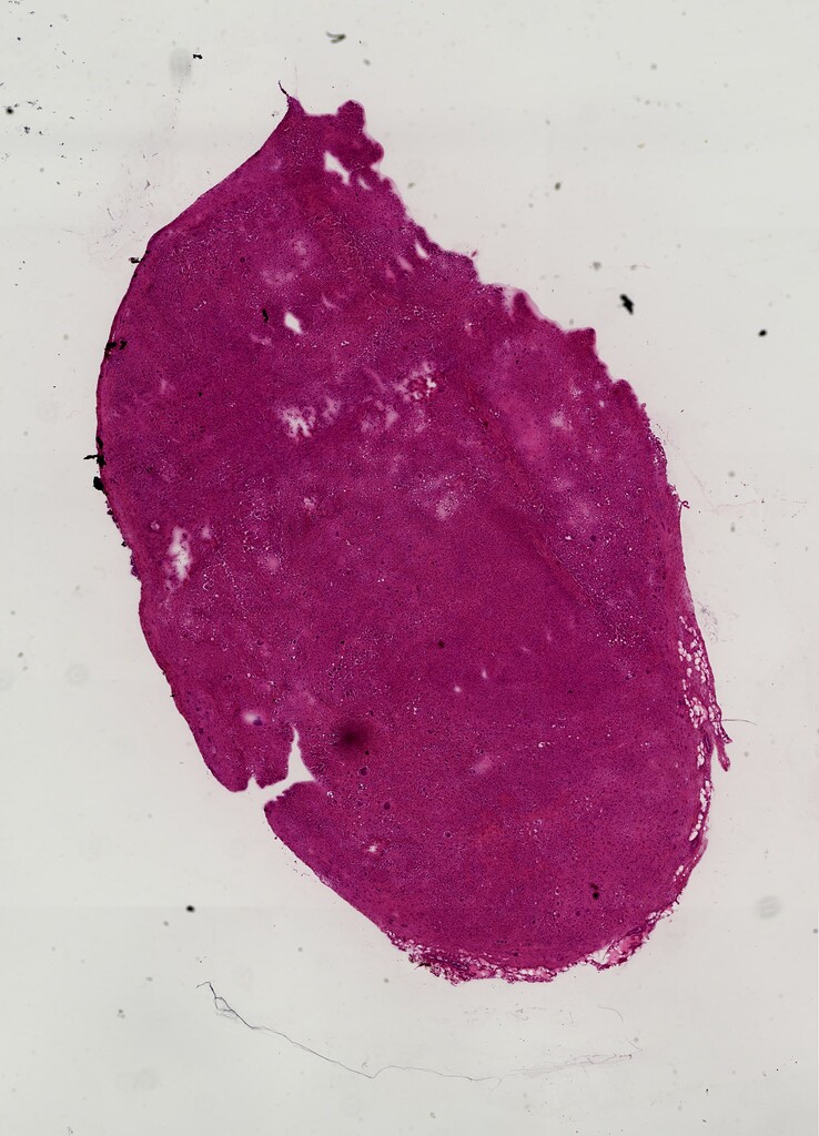 Automated Detection and Analysis of Tissue Holes in Brightfield Microscopy Images using Imagej ...