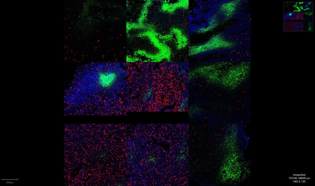 Documentation on Haralick features - Usage & Issues - Image.sc Forum