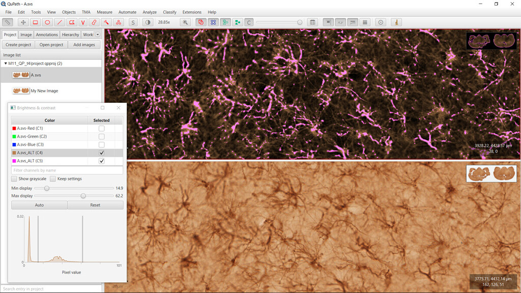ᴗ• Qupath Scripting 2 Using Clupath And Ij To Show Image With Additional Local Threshold