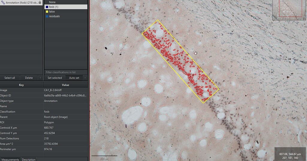 How to quantify positive DAB cell on multiple images? - Image Analysis - Image.sc Forum