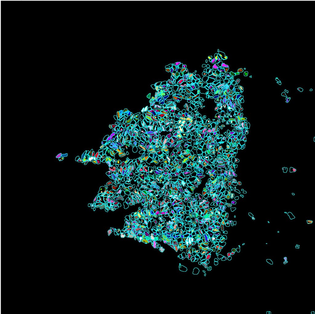 Colocalization analysis using roi and mask - Image Analysis - Image.sc ...