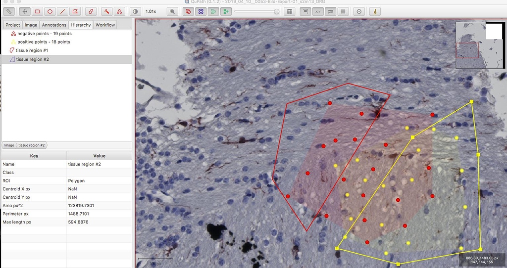 Assign point objects to different ROIs by overlap - Usage & Issues - Image.sc Forum