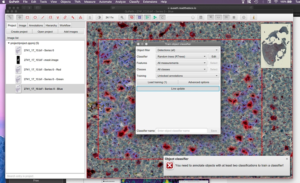 QuPath - multiplexed analysis - Image Analysis - Image.sc Forum