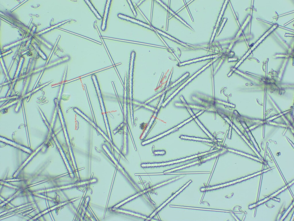 Measurement of sponge spicules - Image Analysis - Image.sc Forum