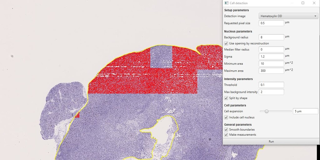 Cell detection - only quantifying partial area - Image Analysis - Image.sc Forum