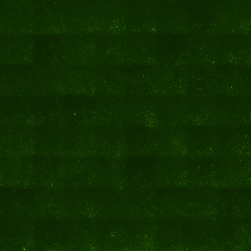 Un-stitching ND2 Large-Image Scans & Fixing Mosaic Background / Uneven Illumination - Image ...