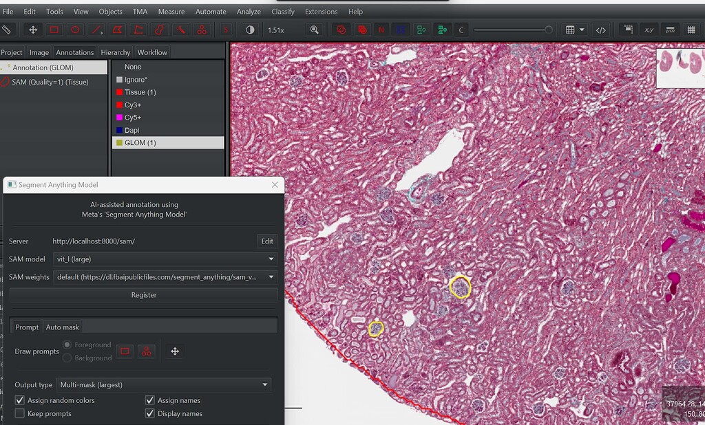 Convert Annotations Into Detections In Qupath Image Analysis Image Sc Forum