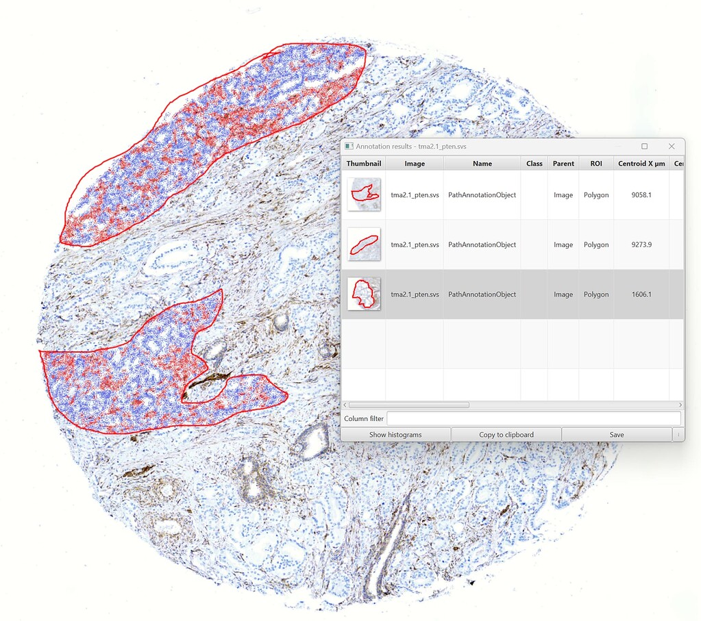 TMA measurement grouping using annotations - Image Analysis - Image.sc Forum