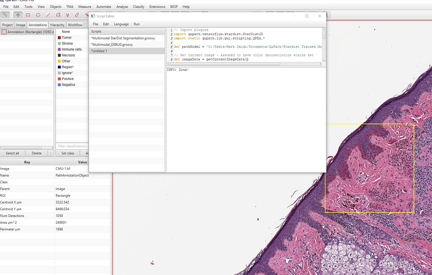 Universal StarDist for QuPath - Transfer Pretrained Models Across Modalities With Ease ...
