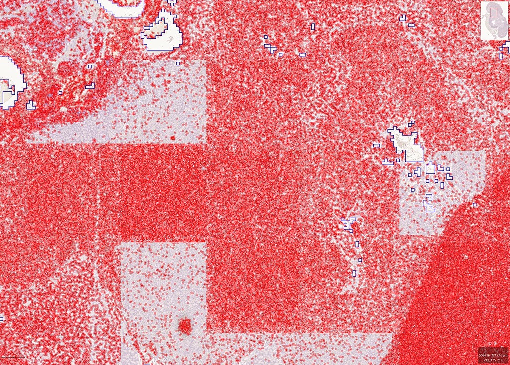 Blocky cell detection with QuPath - Usage & Issues - Image.sc Forum