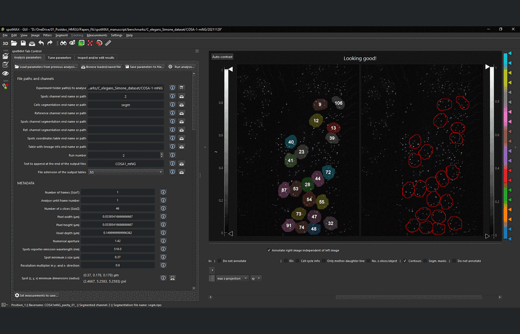 Announcing SpotMAX, a Python tool for the analysis of multi-dimensional fluorescence microscopy ...