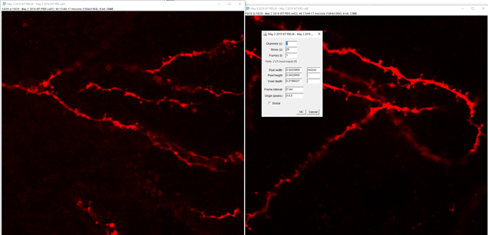 Unable to open .lif files in ImageJ - Usage & Issues - Image.sc Forum