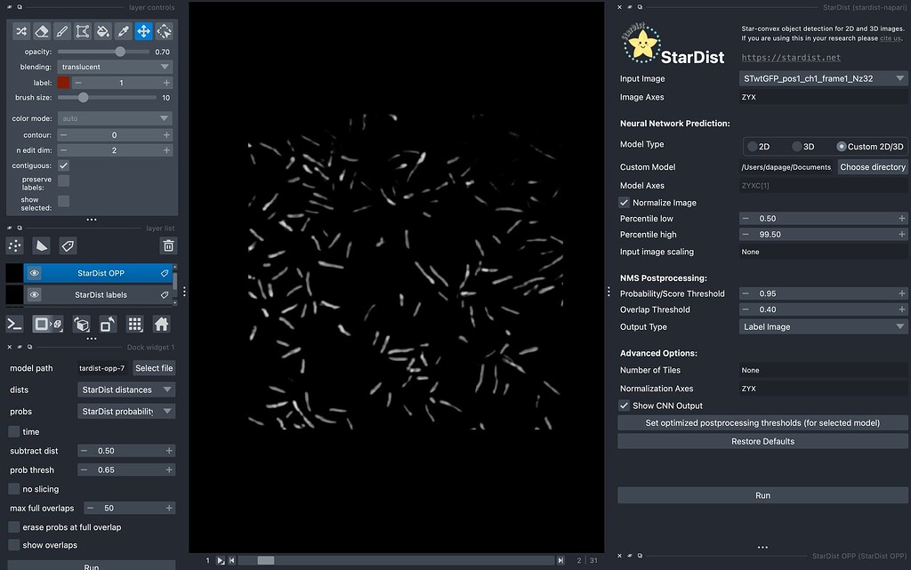 Pixelated segmentation output with stardist/stardistOPP - Image Analysis - Image.sc Forum