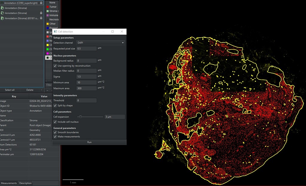 Cell detection not on full annotation in Qupath - Image Analysis - Image.sc Forum