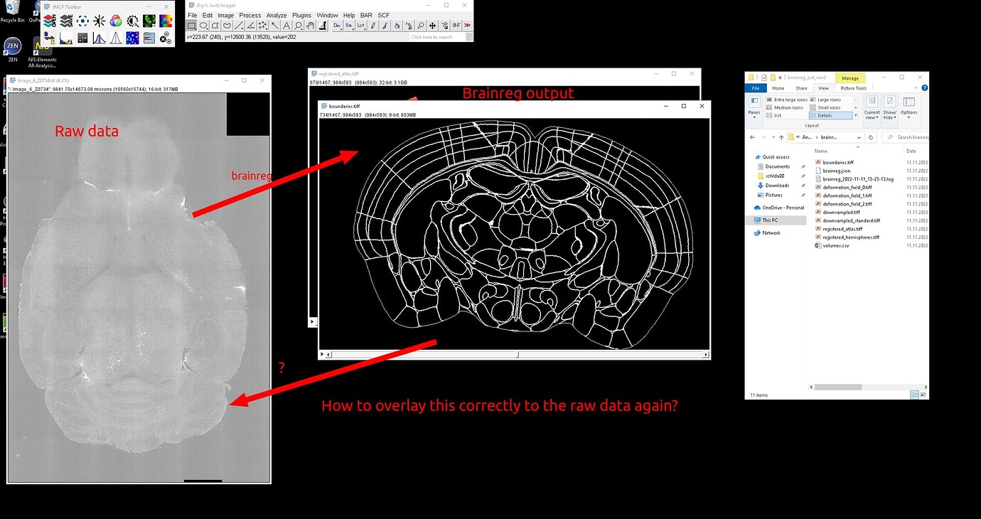 How to overlay brainreg boundary and atlas label image with full ...