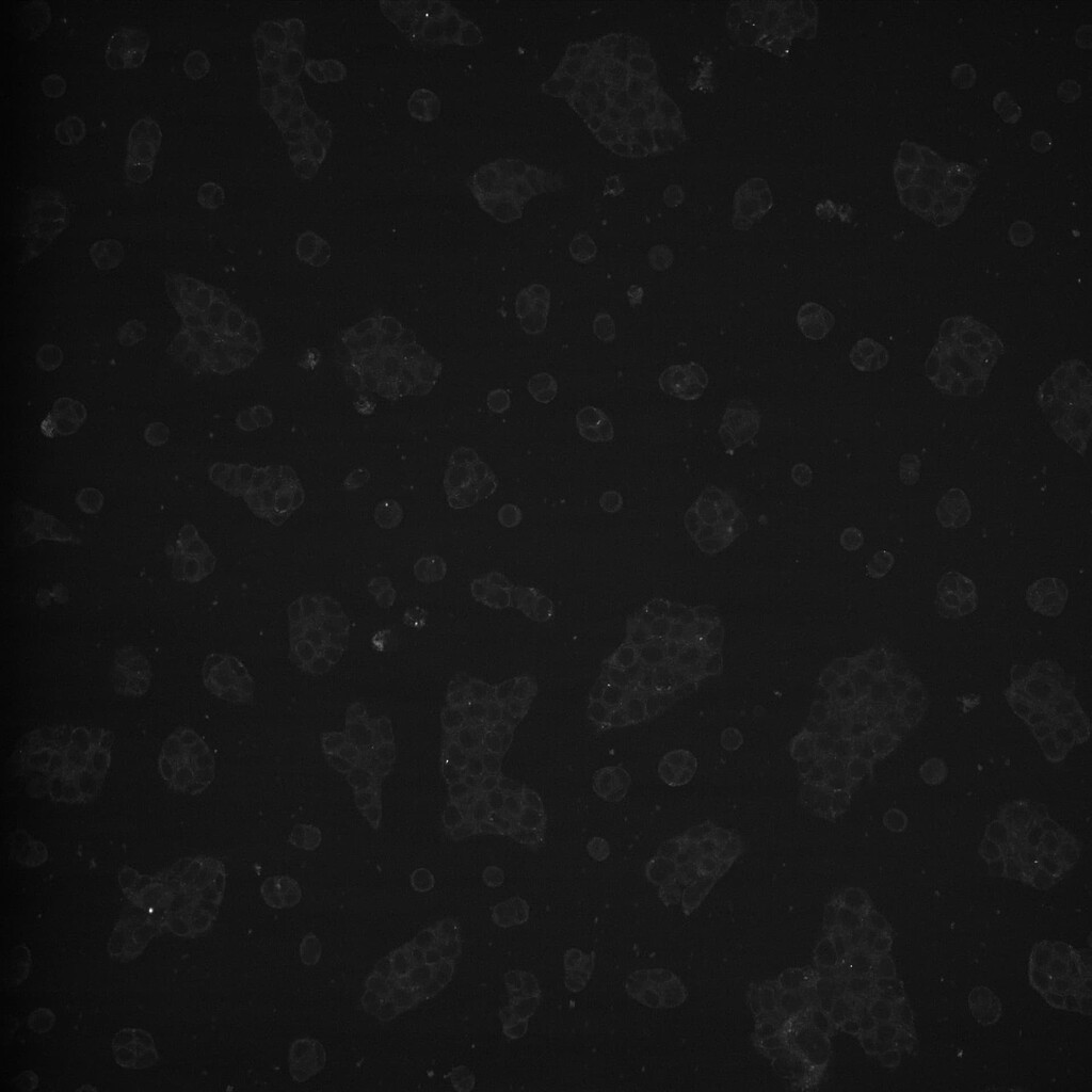 Difficulties with segmentation of clumped cells - CellProfiler - Image Analysis - Image.sc Forum