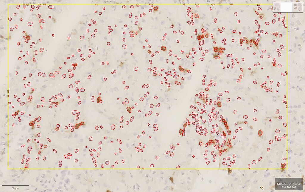 InstanSeg and classifying positive cells with varying staining ...