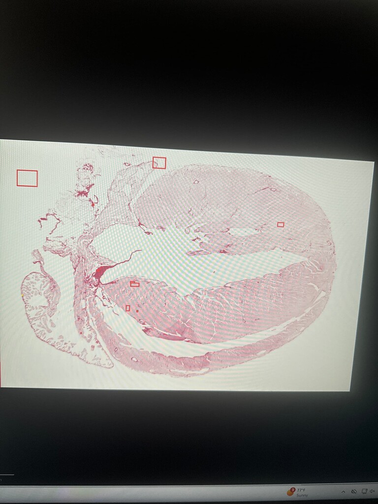 Setting color vectors for stain separation - Image Analysis - Image.sc ...